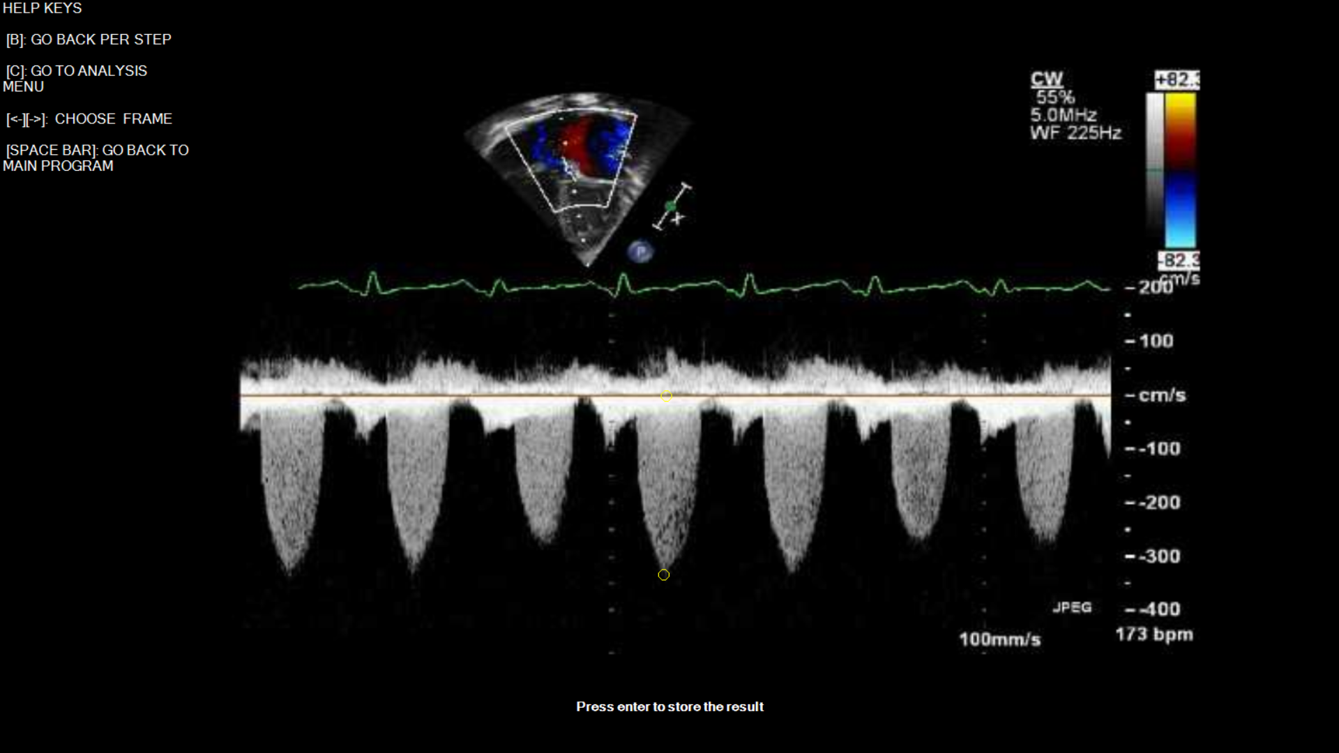 VETSPEDS - Neonatal Echocardiography Simulation